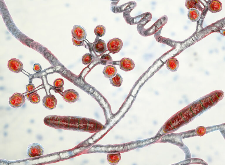 Tmvii Infections Fungus Education Hub